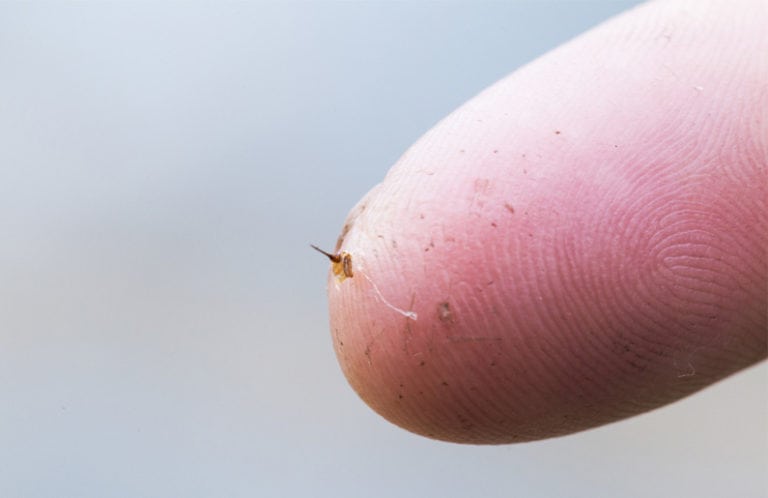 CUNA: 8 Picaduras comunes y cómo identificarlas