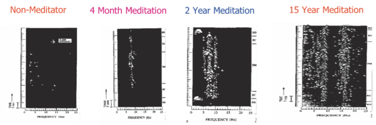 Qué es la educación consciente, del modelo del Dr. Taddy Blecher