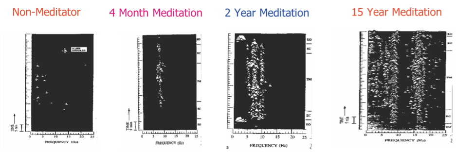 Qué es la educación consciente, del modelo del Dr. Taddy Blecher