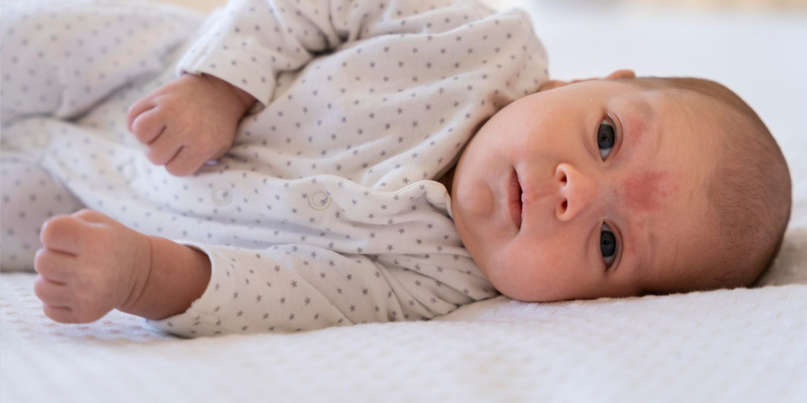 ¿Por qué le salen granos a los bebés?